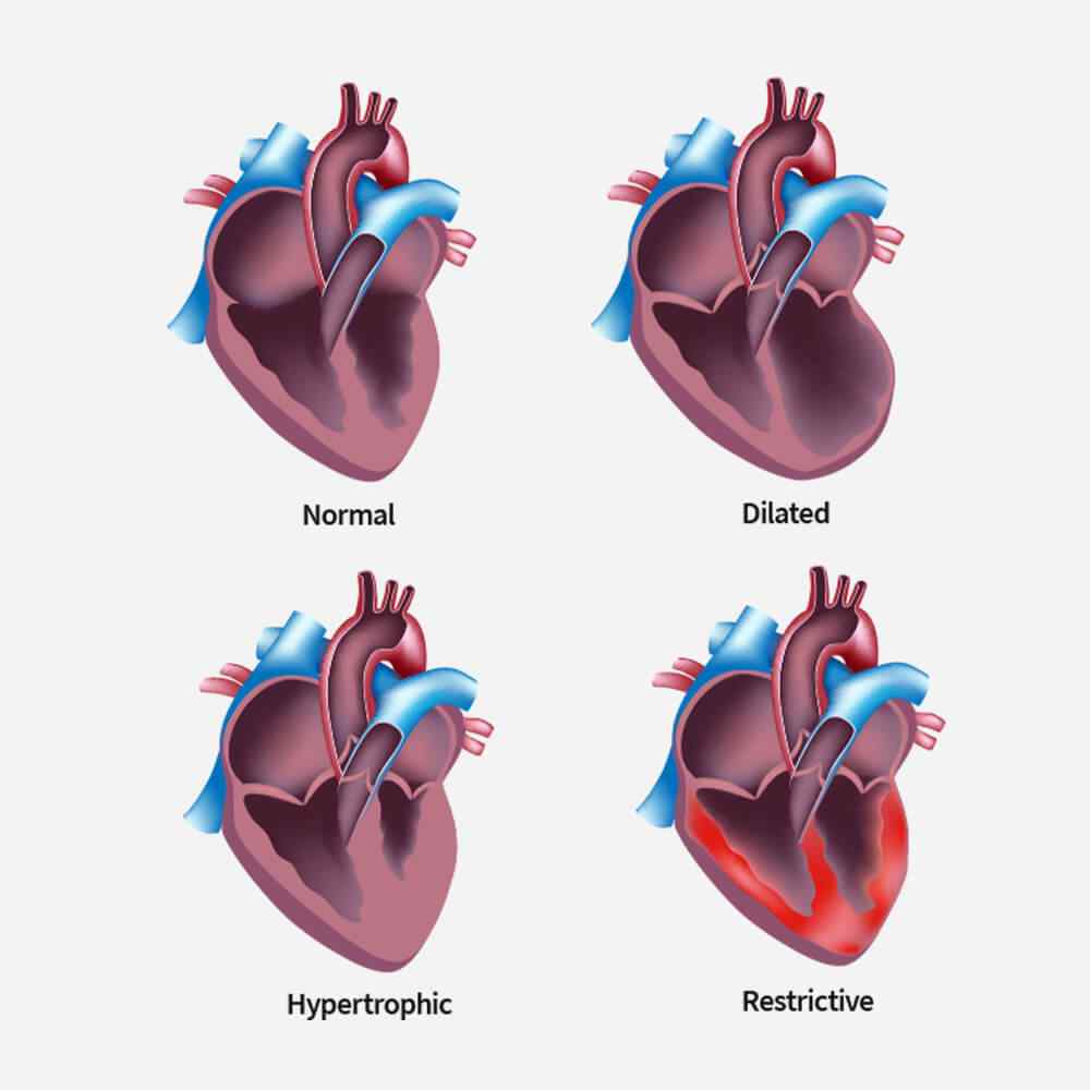 Understanding Common Heart Conditions & Symptoms | Mr AlJaaly
